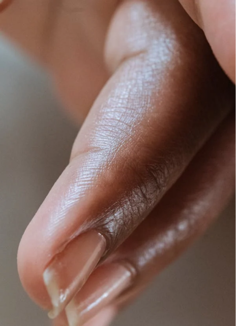 Dark Lines on Nails: What Do They Mean? - Find A Black Doctor