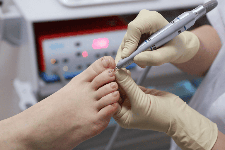Understanding Partial Toenail Removal: What to Expect - Find A Black Doctor